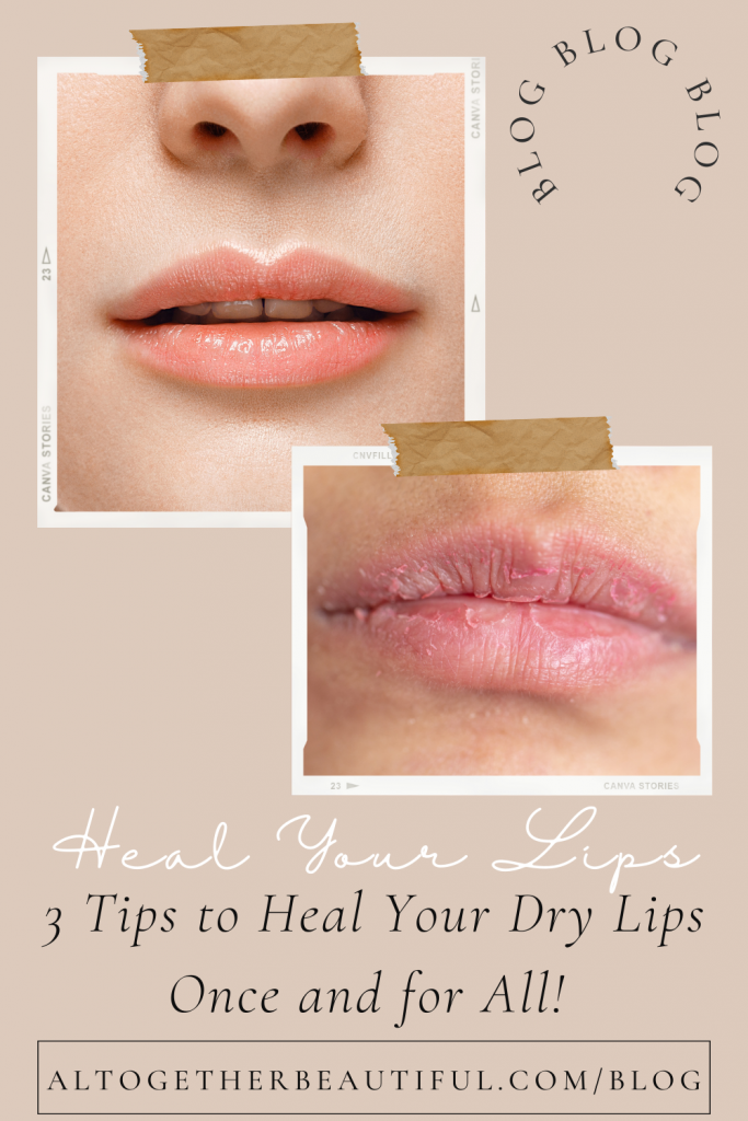 3 Tips to Heal Your Dry Lips Once and for All | altogetherbeautiful.com